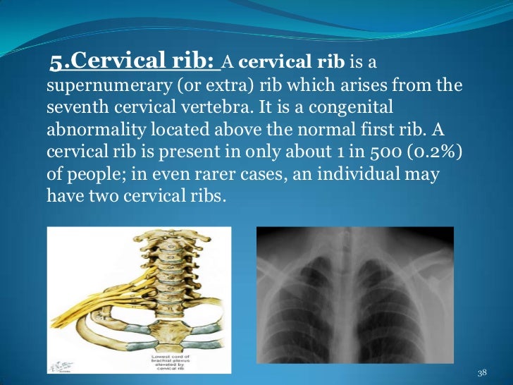 Deformities Of Human Body