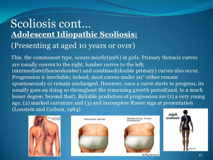 Deformities Of Human Body