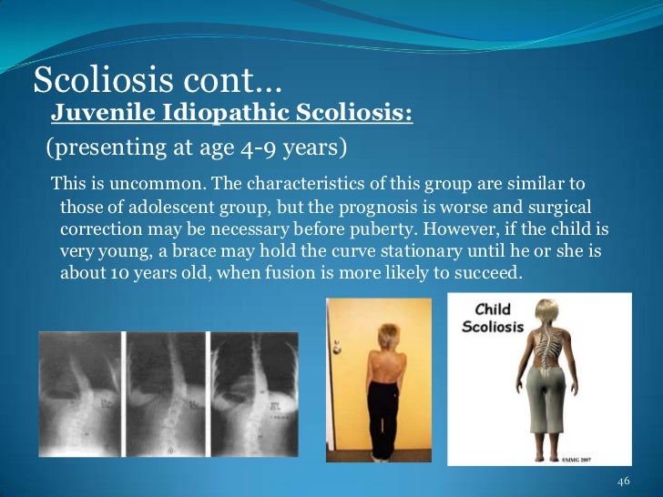Deformities Of Human Body