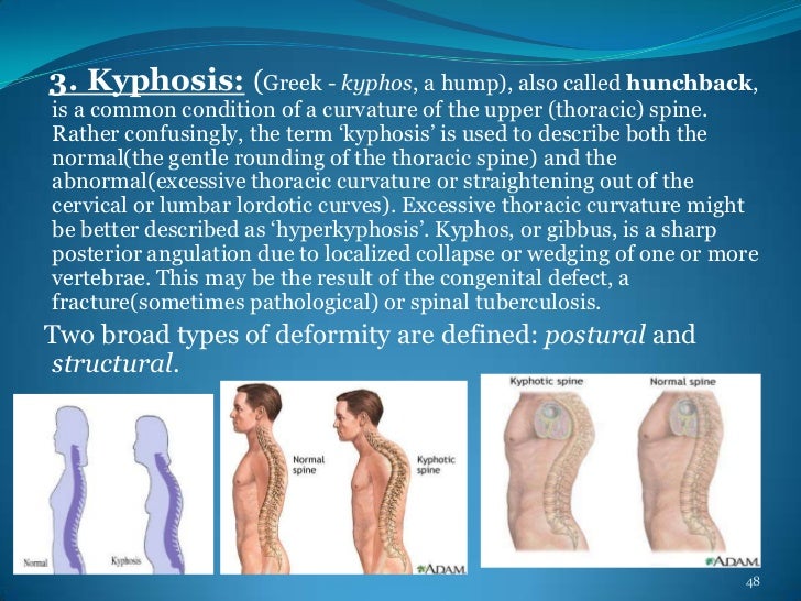 Deformities Of Human Body