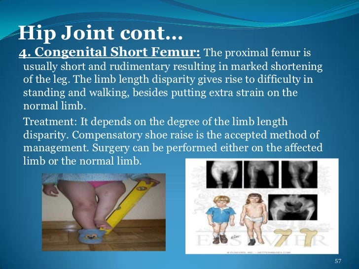 Deformities Of Human Body