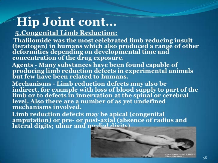 Deformities Of Human Body