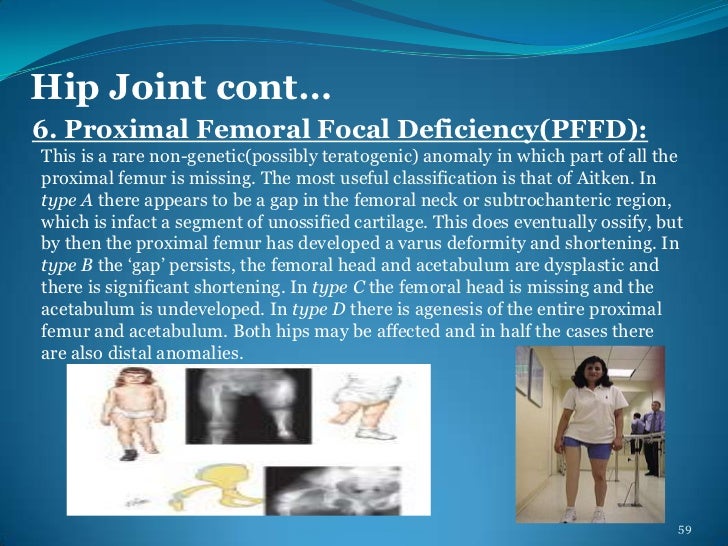 Deformities Of Human Body