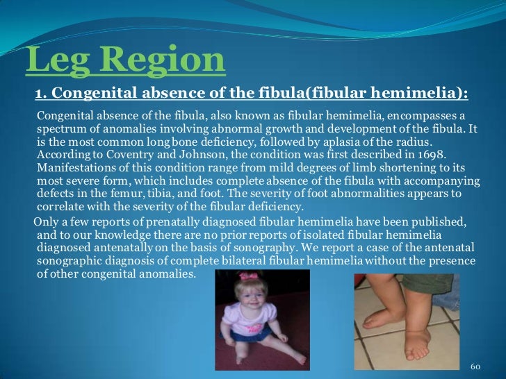 Deformities Of Human Body