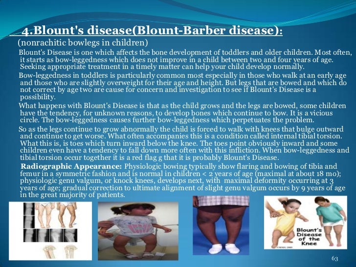 Deformities Of Human Body