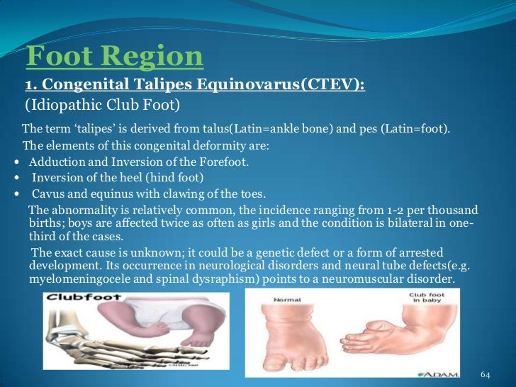 Deformities Of Human Body