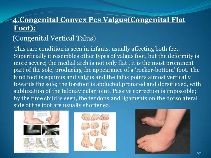 Deformities Of Human Body