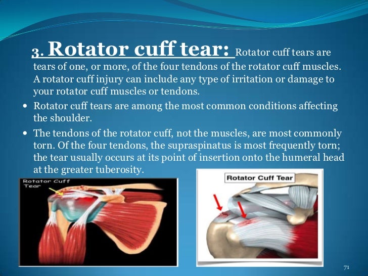 Deformities Of Human Body