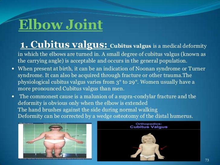 Deformities Of Human Body