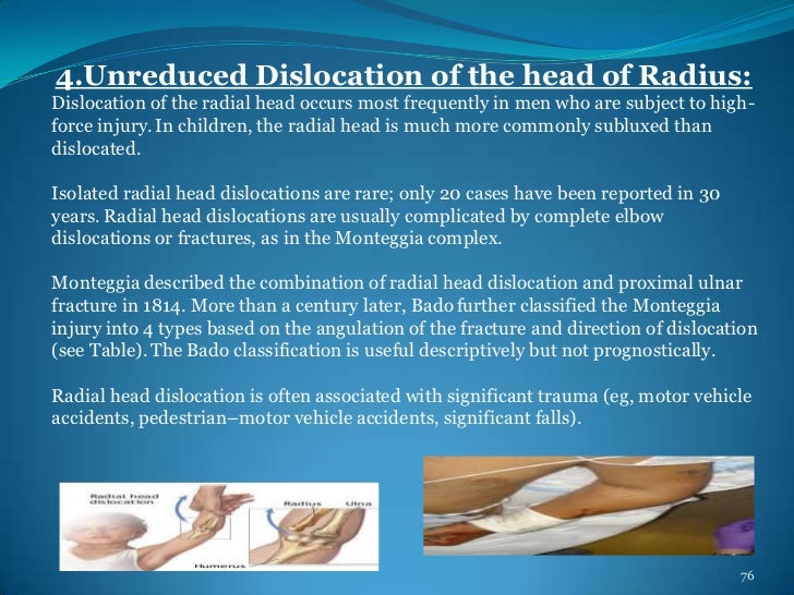 Deformities Of Human Body