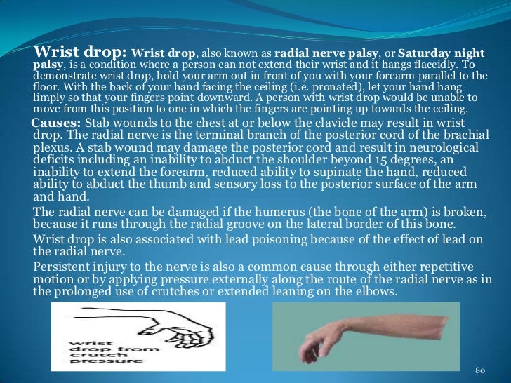 Deformities Of Human Body