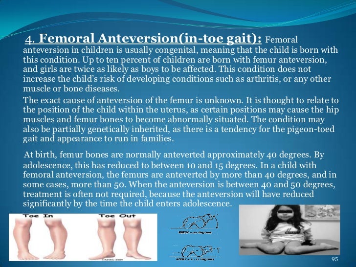 Deformities Of Human Body