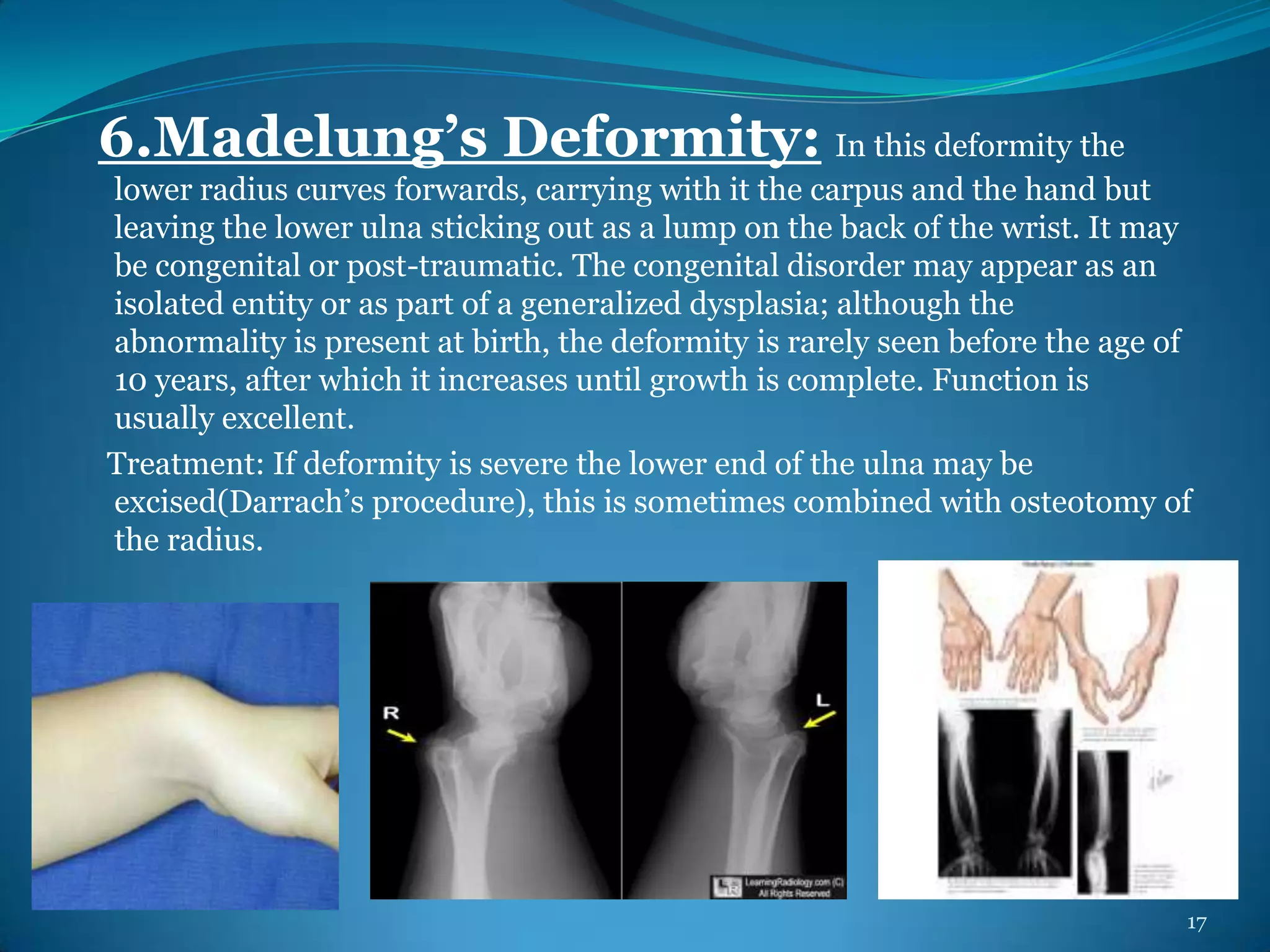 Deformities of human body pps | PPSX