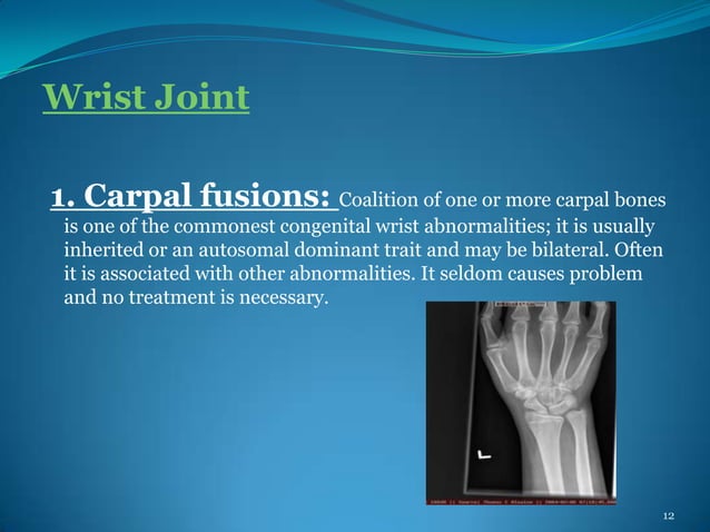 Deformities of human body pps | PPSX | Death, Injury, or Military ...