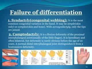 Deformities of human body pps | PPSX