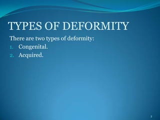 Deformities of human body pps | PPSX