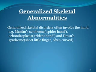 Deformities of human body pps | PPSX