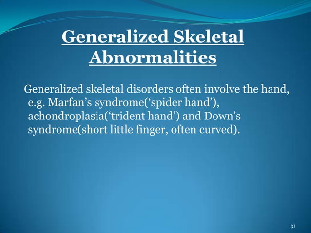 Deformities of human body pps | PPSX | Death, Injury, or Military ...