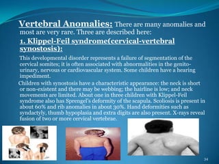 Deformities of human body pps | PPSX
