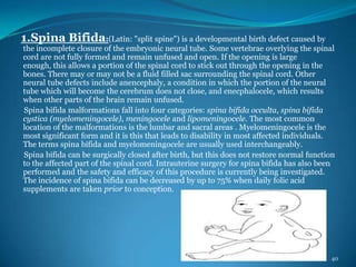 Deformities of human body pps | PPSX