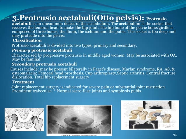 Deformities of human body pps