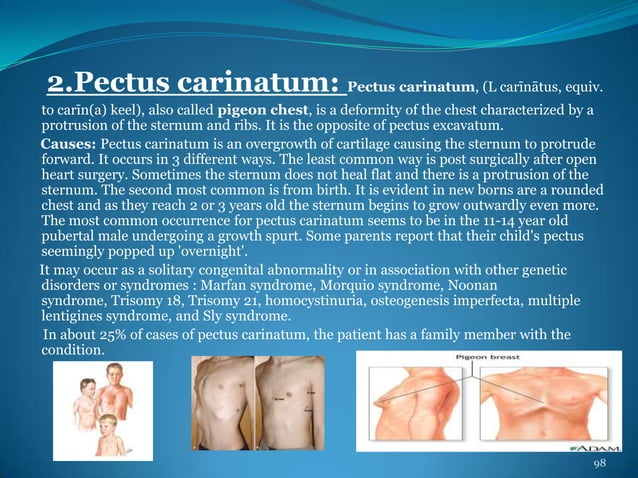 Deformities of human body pps