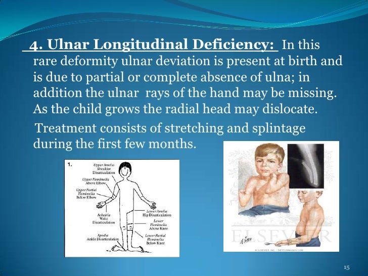 Deformities of human body pps