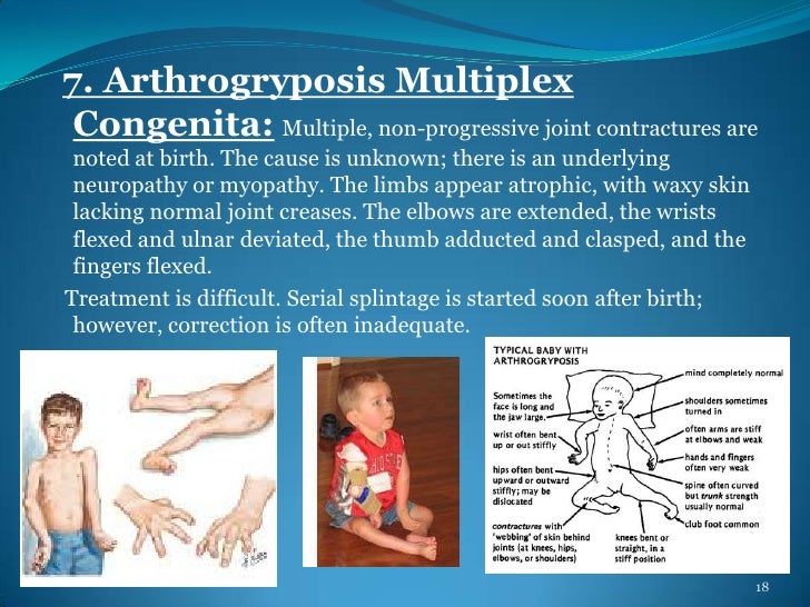 Deformities of human body pps
