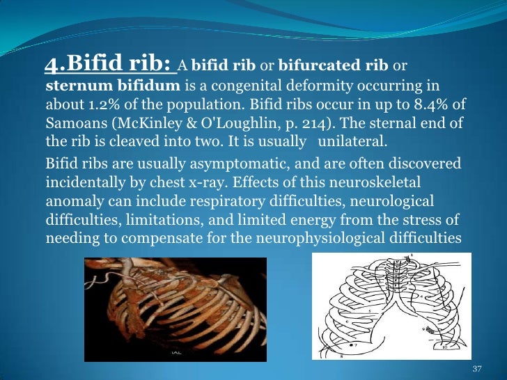 Deformities of human body pps