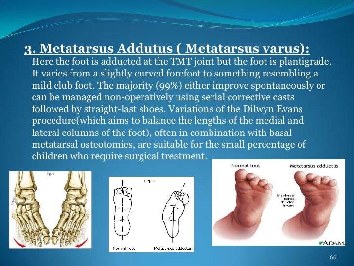 Deformities of human body pps