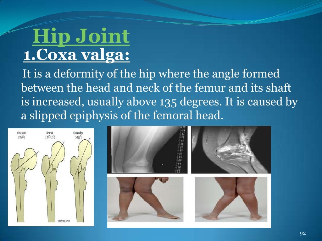 Deformities of human body pps