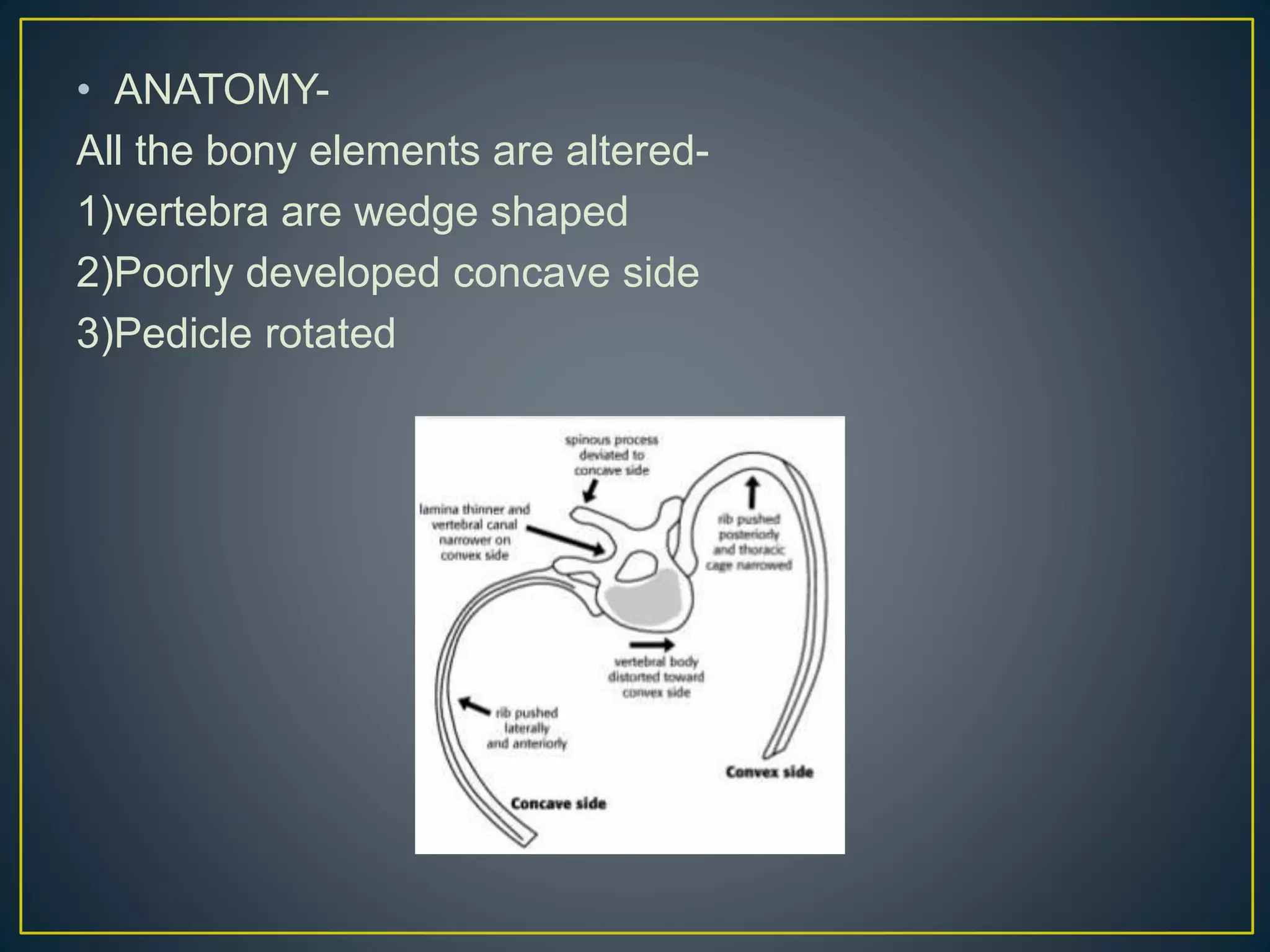 Deformities of spine | PPTX