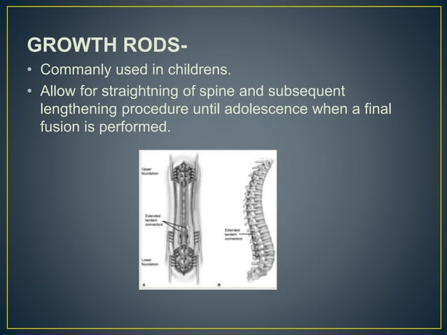 Deformities of spine | PPTX | Physical Therapy | Wellness