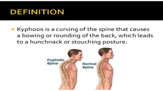deformity-disorder.pptx