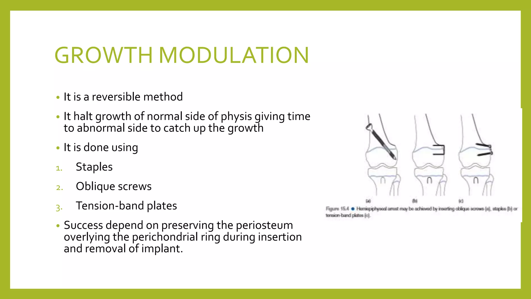 Deformity around knee joint | PPTX