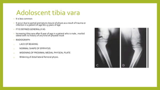 Deformity around knee joint | PPTX