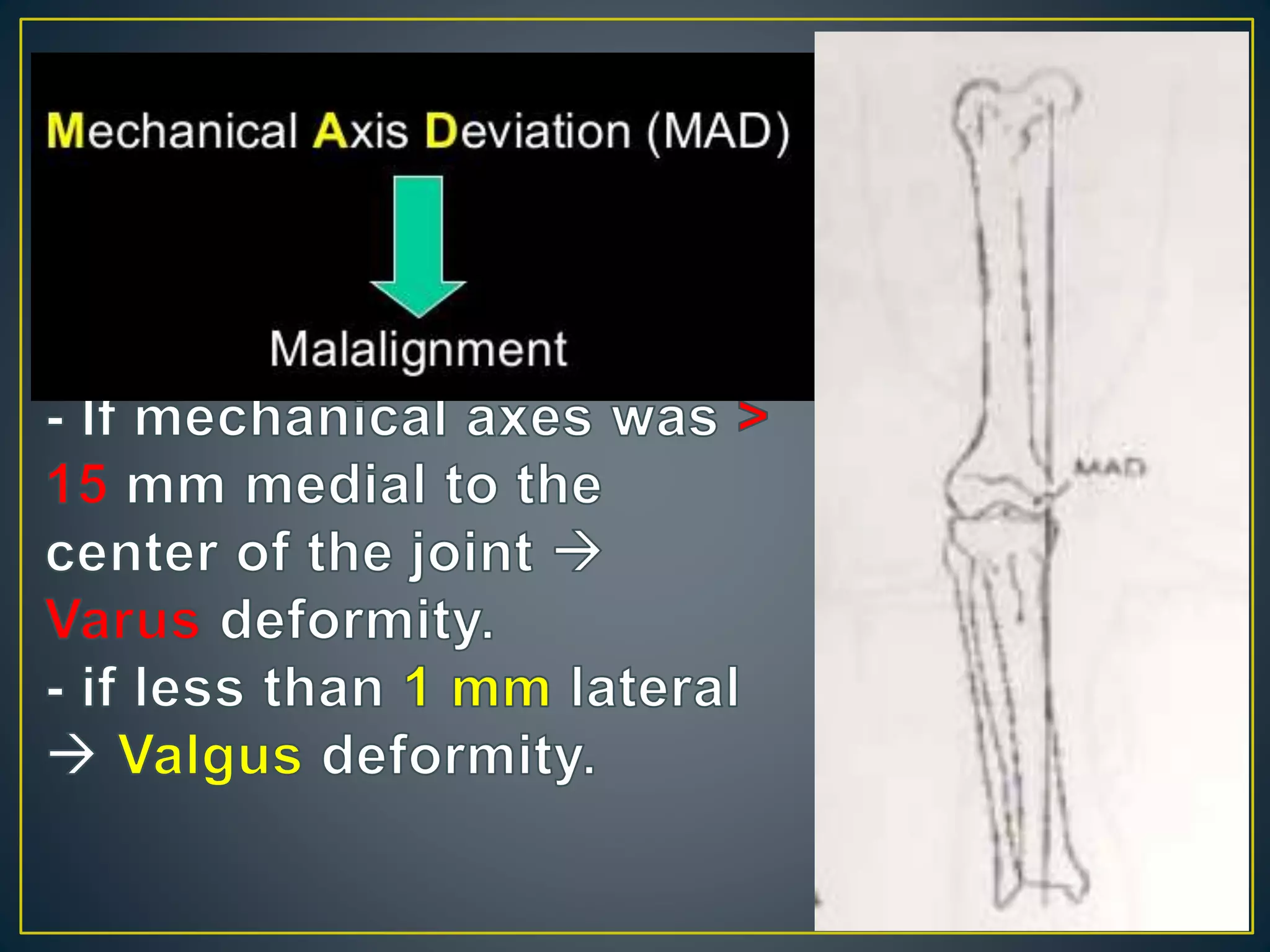 Deformity correction | PPT