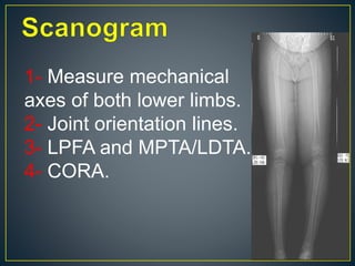 Deformity correction | PPTX