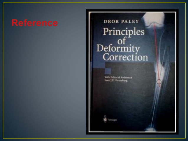 Deformity correction | PPTX