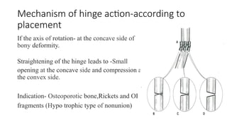 Deformity correction in relation to hinge and osteotomy.pptx