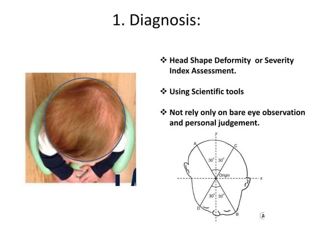Plagiocephaly Measurement with Craniometer: Diagnosis, Prevention ...