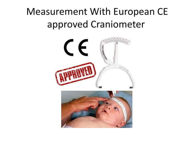 Plagiocephaly Measurement with Craniometer: Diagnosis, Prevention ...