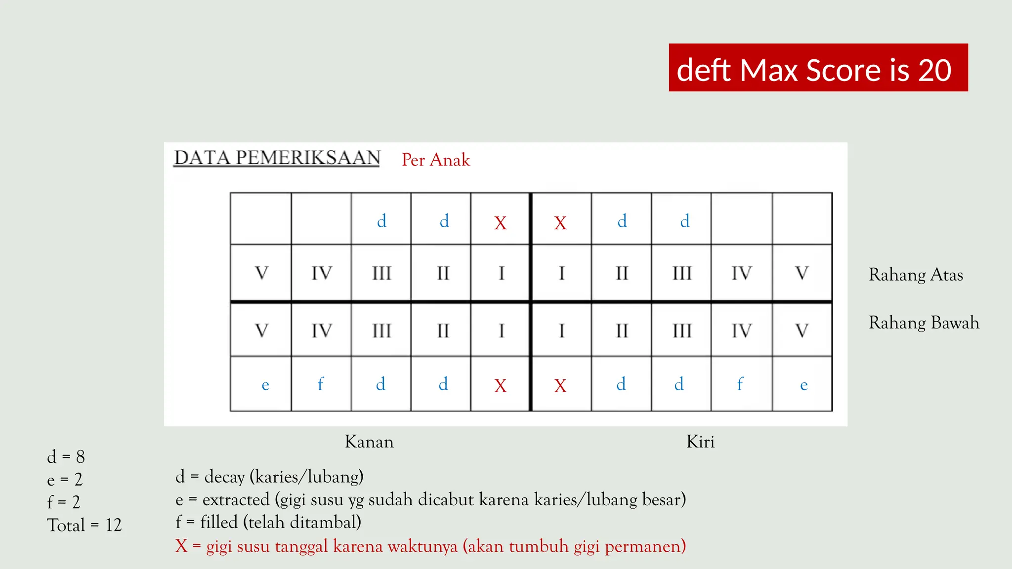 deft INDEX karies gigi desidui pada anak.pptx