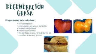 Degeneración e Infiltración.pdf diapositivas | PDF