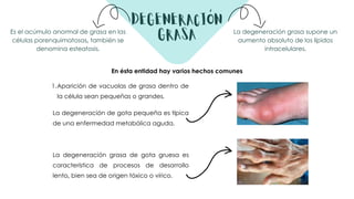 Degeneración e Infiltración.pdf diapositivas | PDF