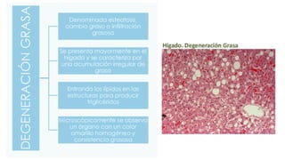 Degeneración e Infiltración.pdf diapositivas | PDF