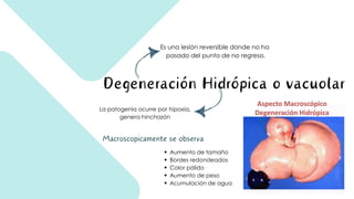 Degeneración e Infiltración.pdf diapositivas | PDF