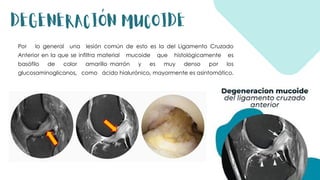 Degeneración e Infiltración.pdf diapositivas | PDF