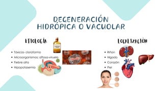 Degeneración e Infiltración.pdf diapositivas | PDF