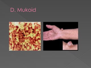 Degenerasi dan nekrosis sel_power point presentation | PPTX